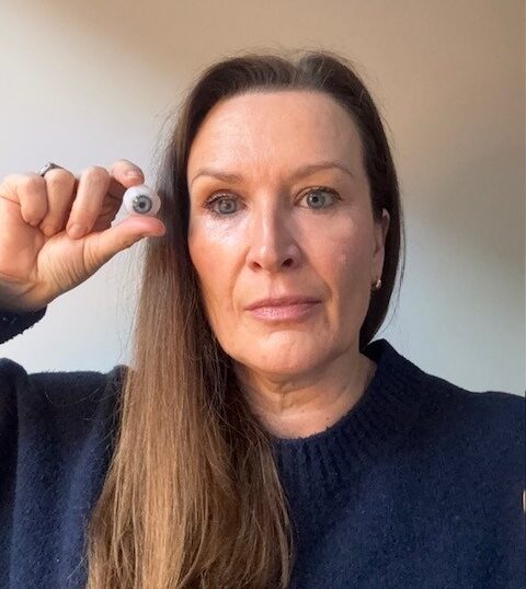 What’s it like to have a prosthetic eye? And how does it work, anyway?